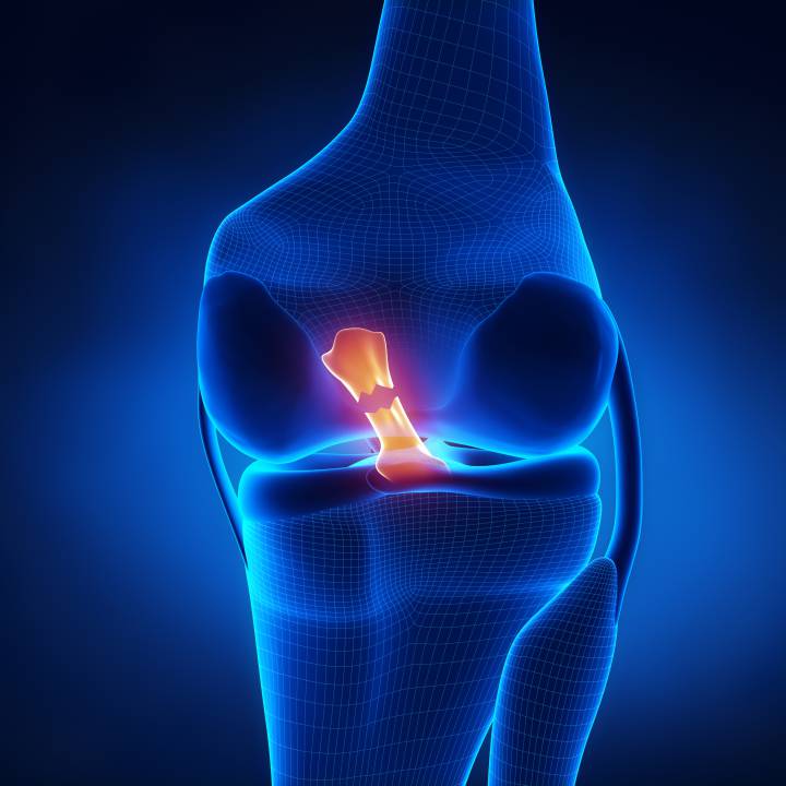 Knie Aandoeningen Dienst Orthopedie Yperman Ieper Orthopedie Yperman Knie Aandoeningen Dienst Orthopedie Yperman Ieper Orthopedie Yperman